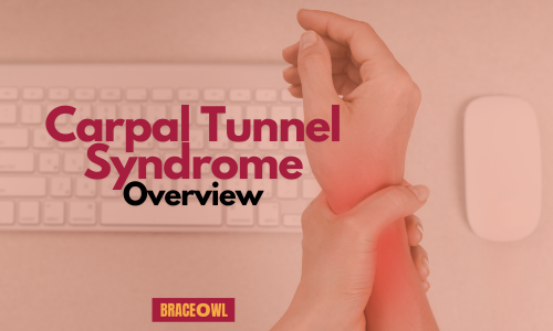 Carpal Tunnel Syndrome - Overview - THE BRACEOWL BLOG